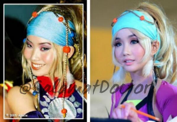Alodia Gosiengfiao Before Surgery