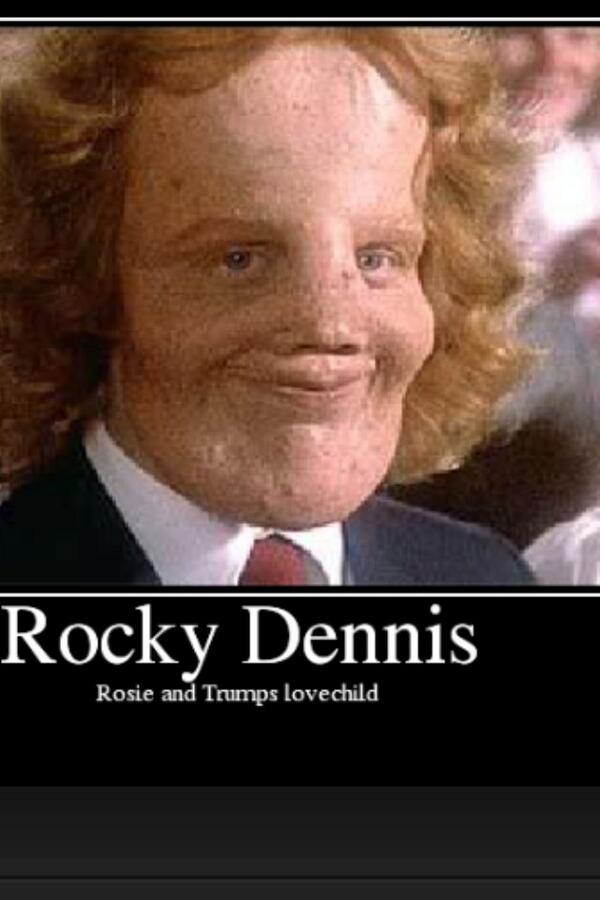 The Elephant Man Movie Cher