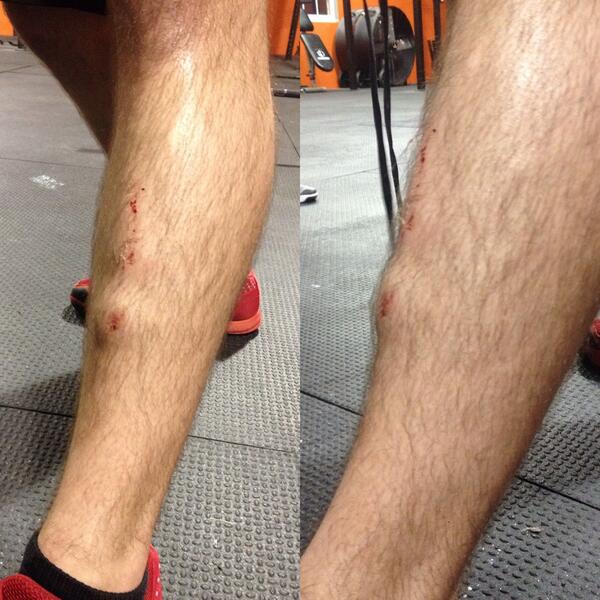 Box Jumps Injury