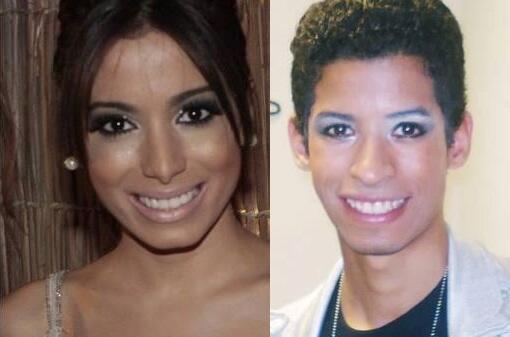 Anitta Antes E Depois Da Cirurgia