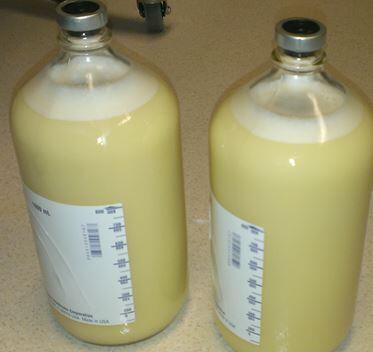 Paracentesis Fluid