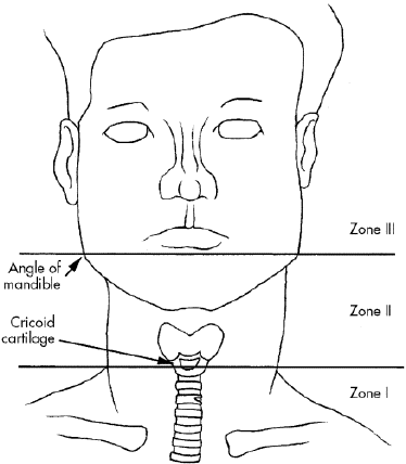 Neck Zones Trauma Head Ppt Powerpoint Presentation Sketch Coloring Page