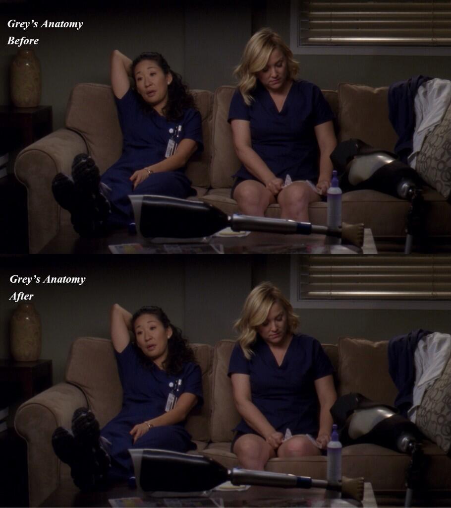 Jessica Capshaw Amputee In Real Life