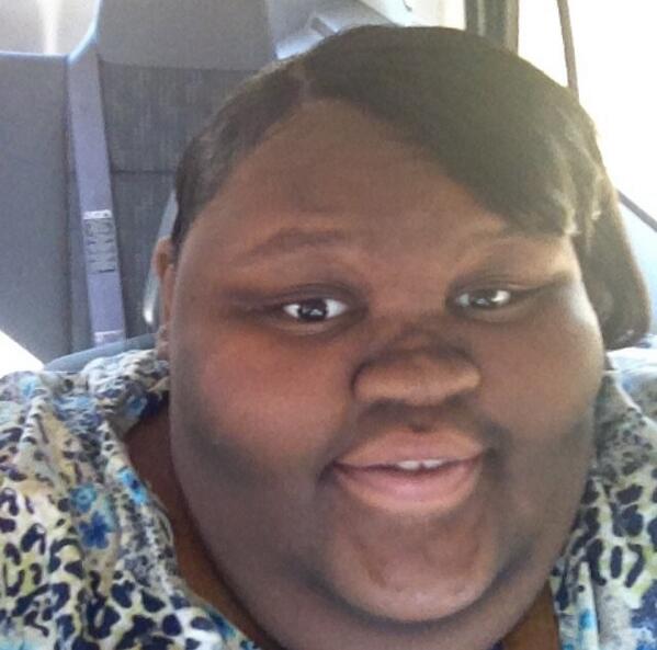 People With Long Chins