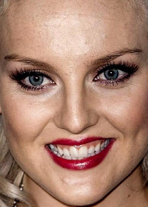 Perrie Edwards Crooked Teeth