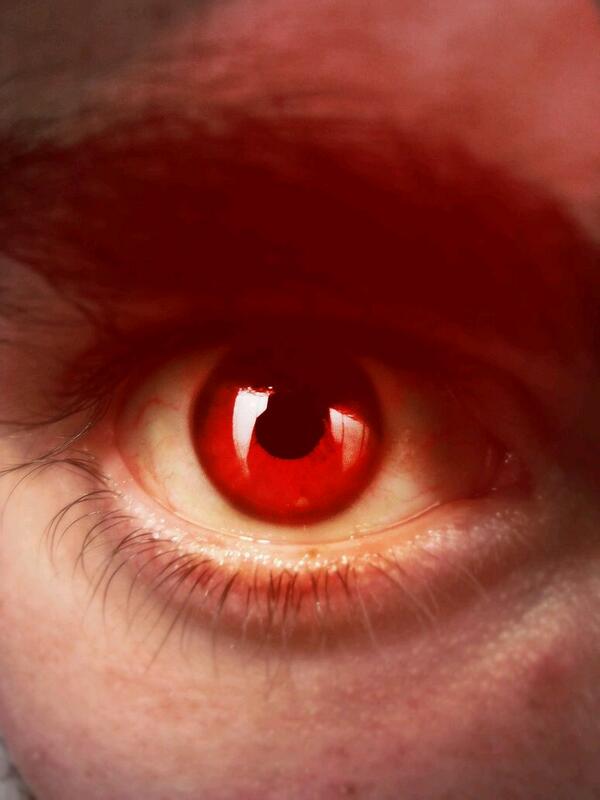 Teen Wolf Alpha Eyes