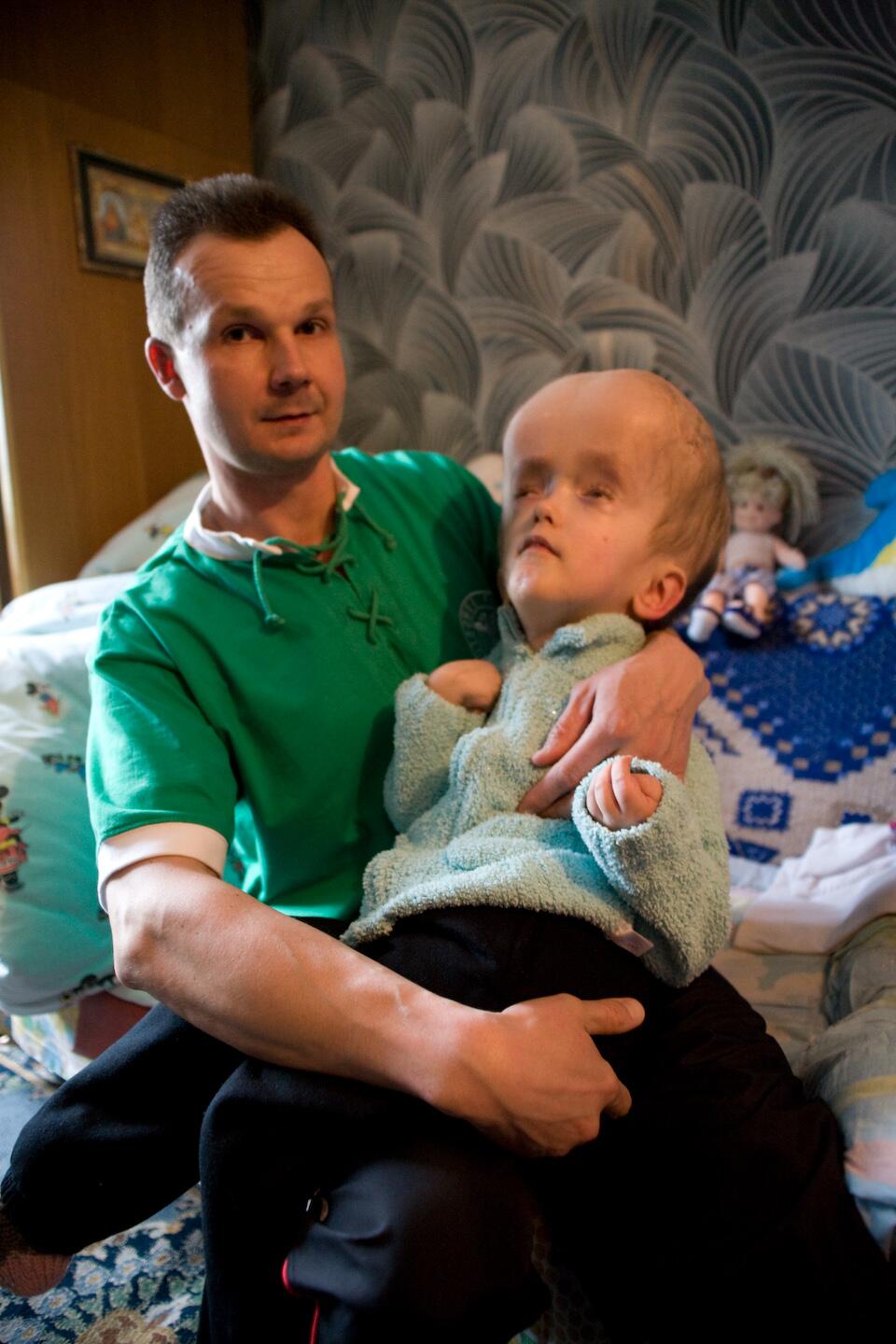 Chernobyl Pictures Children