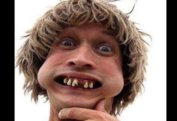 Los Mas Feos Del Mundo