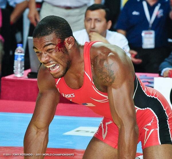 Cauliflower Ear Explodes