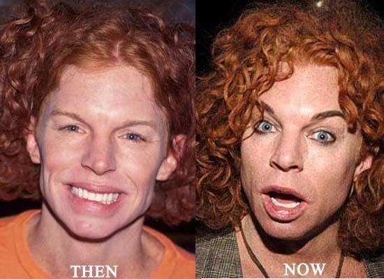 Carrot Top Young