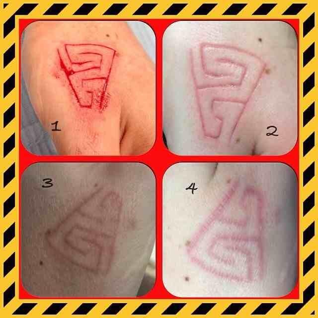 Scarification Healed