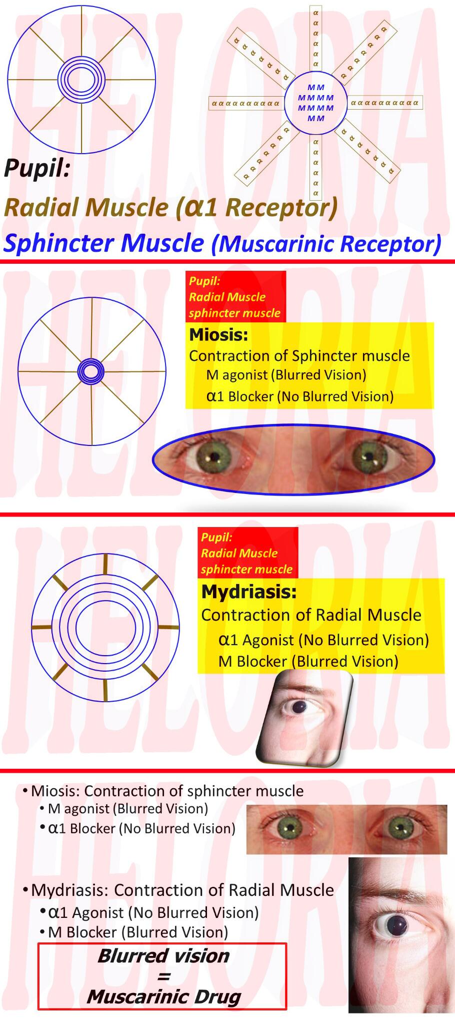 Miosis Vs Mydriasis