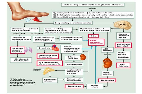 Hypovolemic Shock Chart