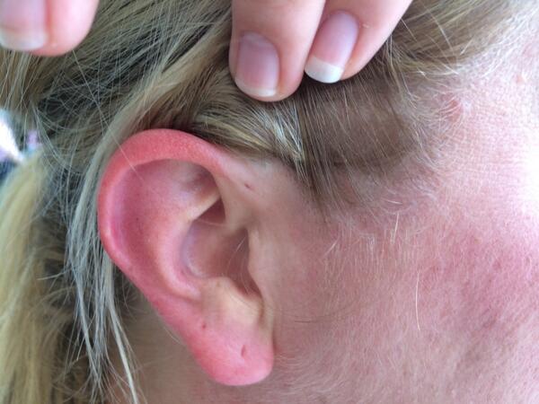 Humans With Gill Slits
