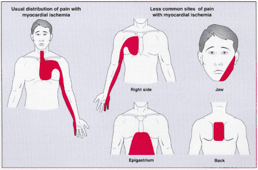 Pain In Left Chest Cavity