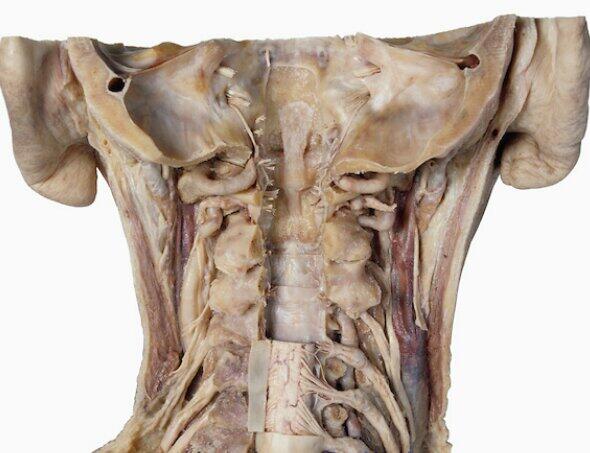 Cadaver Spinal Cord