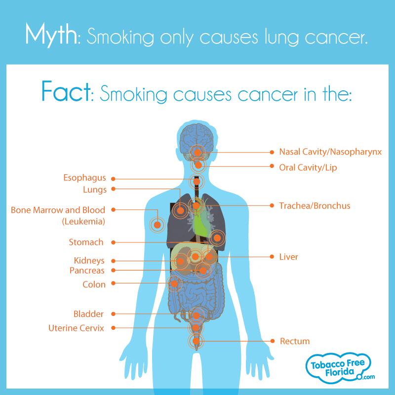 Smoking Causes Lung Cancer Ad