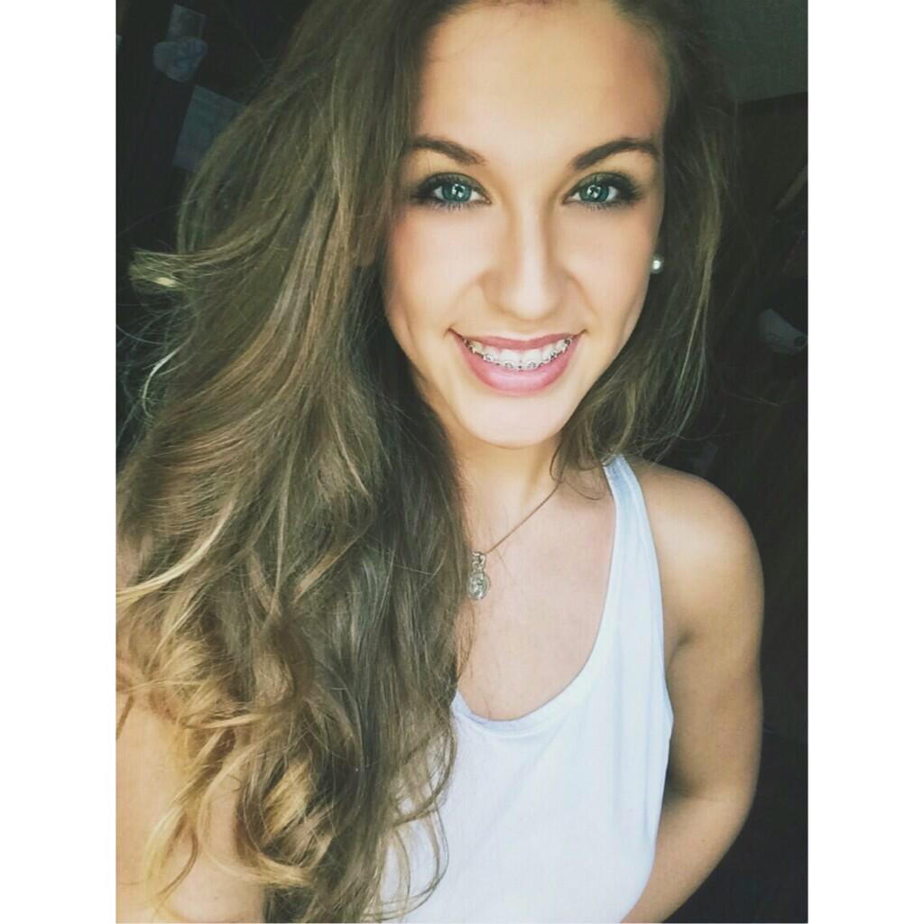 Girls With Braces on Twitter: "Another Awesome Selfie From lilcarolinagirl #braces http://t.co ...