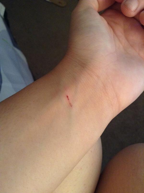 Cuts On Wrist