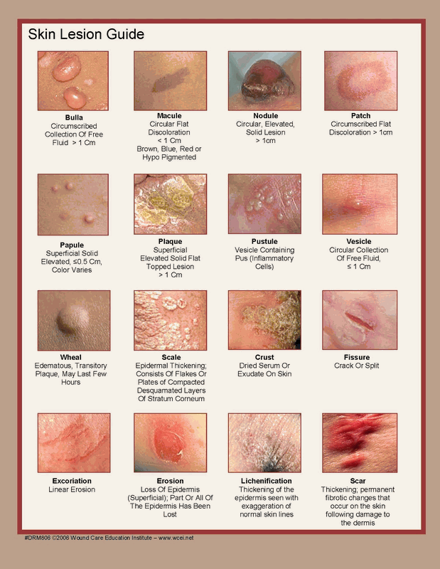 Abbas Husain On Twitter Describing A Rash Use This Reference Guide abbas-husain-on-twitter-describing-a-rash-use-this-reference-guide