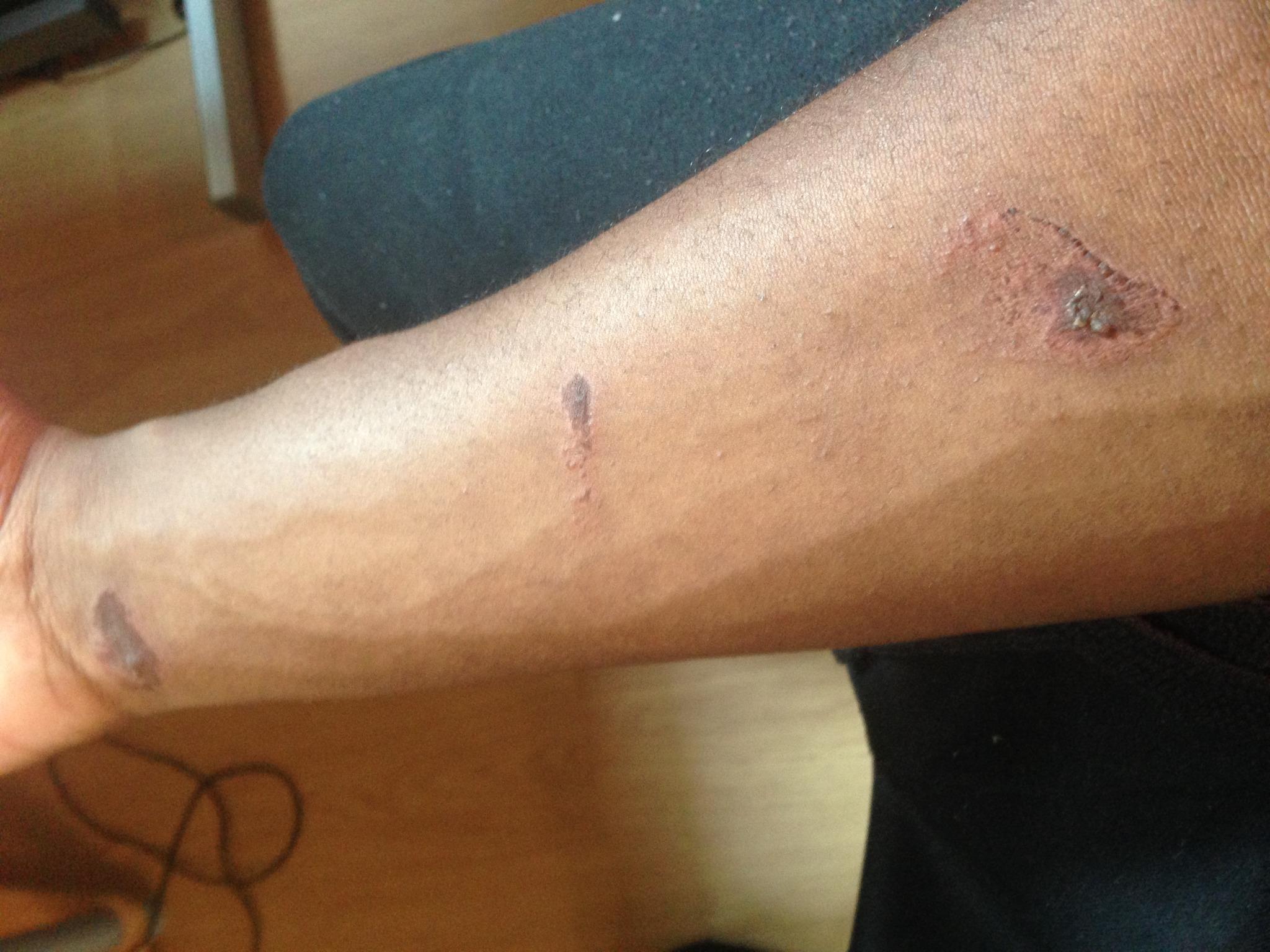 Ice And Salt Challenge