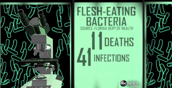 Florida issues flesh-eating bacteria warning: | ABC News | Scoopnest
