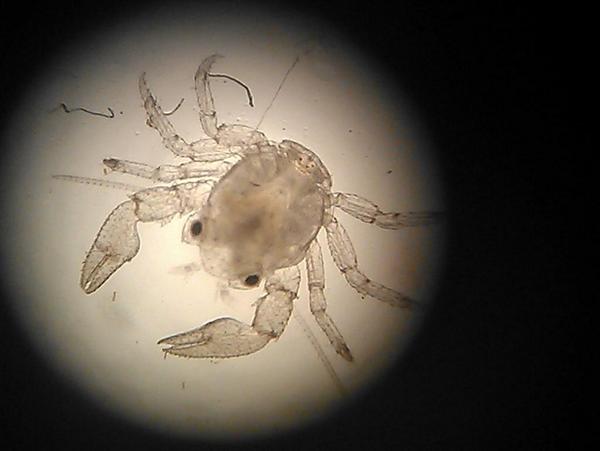 Pubic Lice Under A Microscope