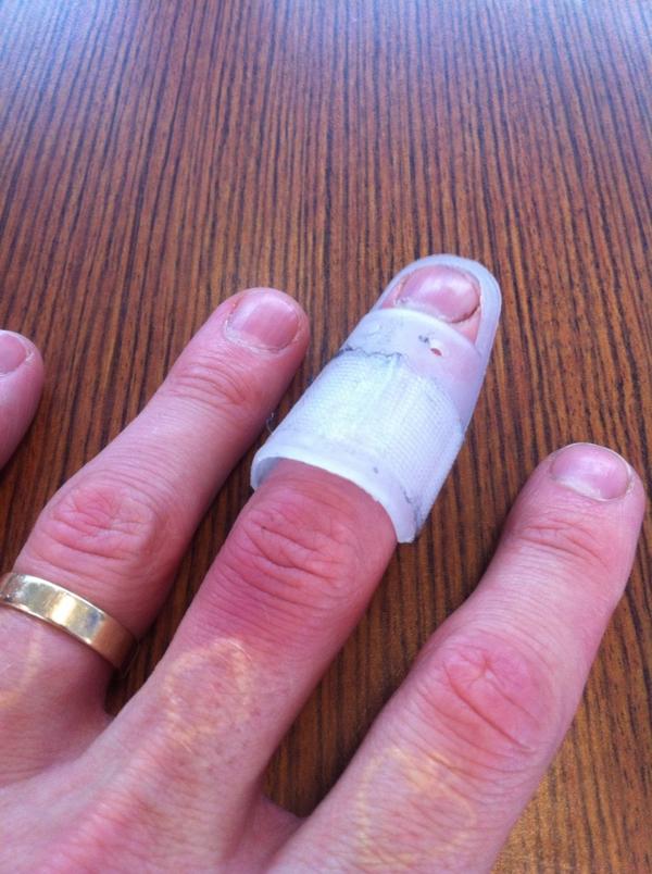 Broken Ring Finger Tip