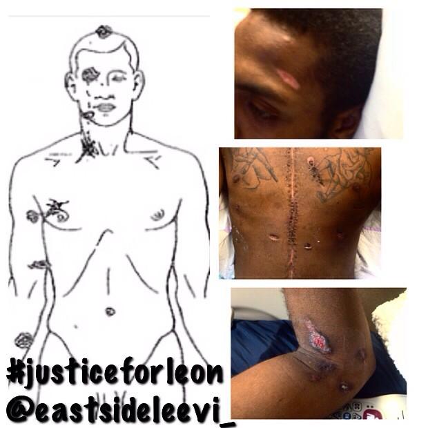 Wounds Michael Brown Body Initial Private Autopsy Said To Show Michael