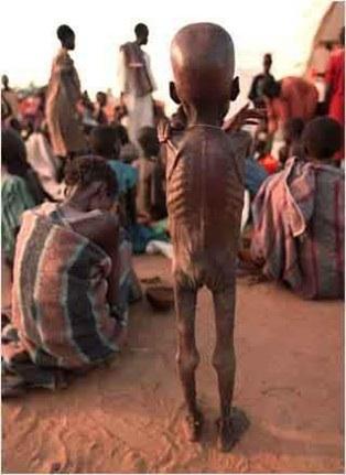 Anorexic African Children
