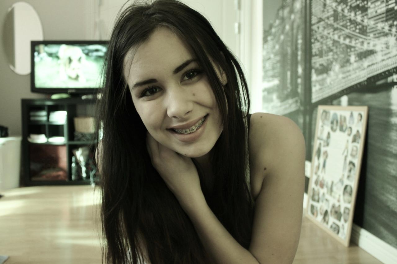 Girls With Braces On Twitter Gorgeous Brunette With A Cute Braces