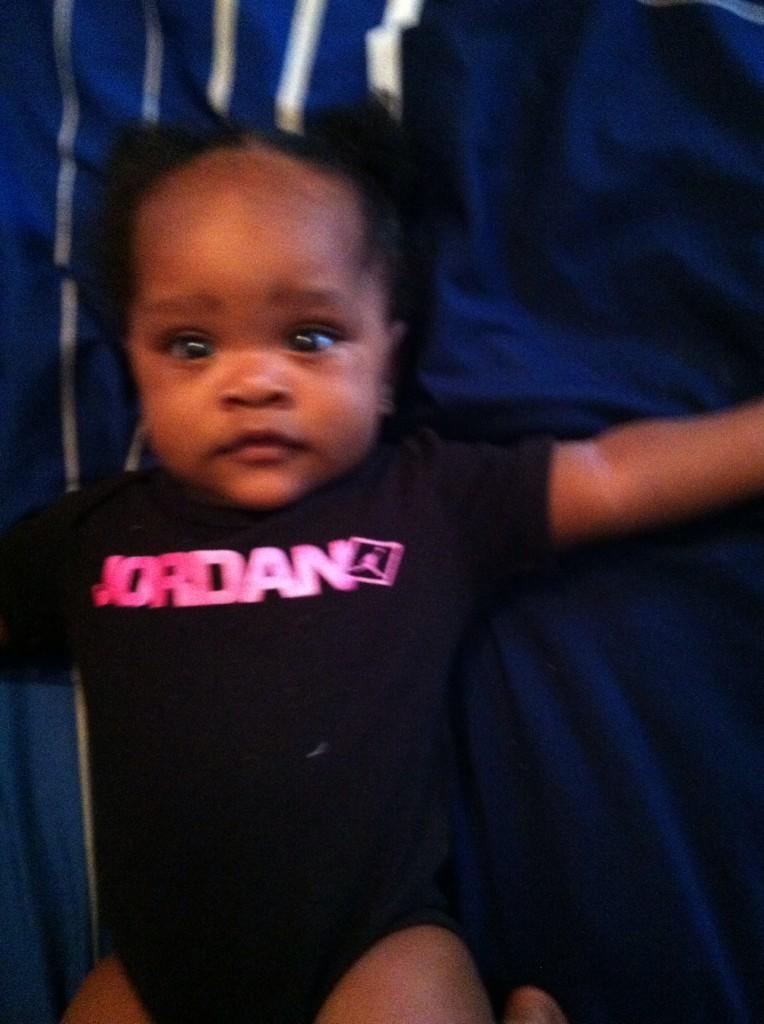 Protruding Forehead Toddler