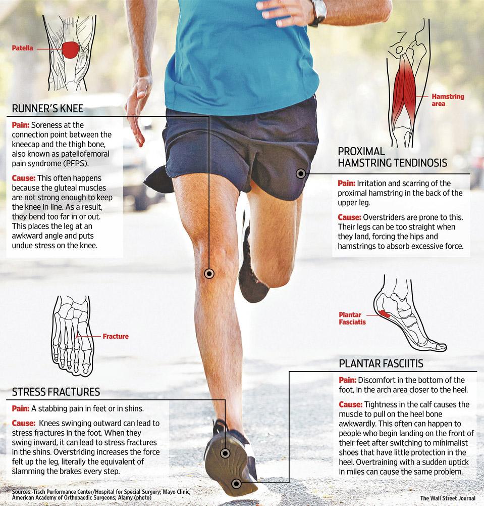 How to Prevent Leg Injuries from Running: Expert Tips - Purefitjourneys