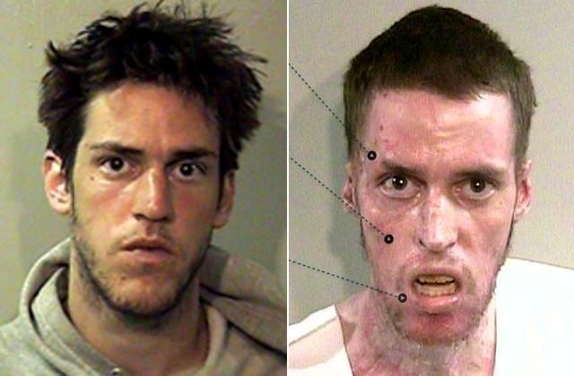 Before And After Meth