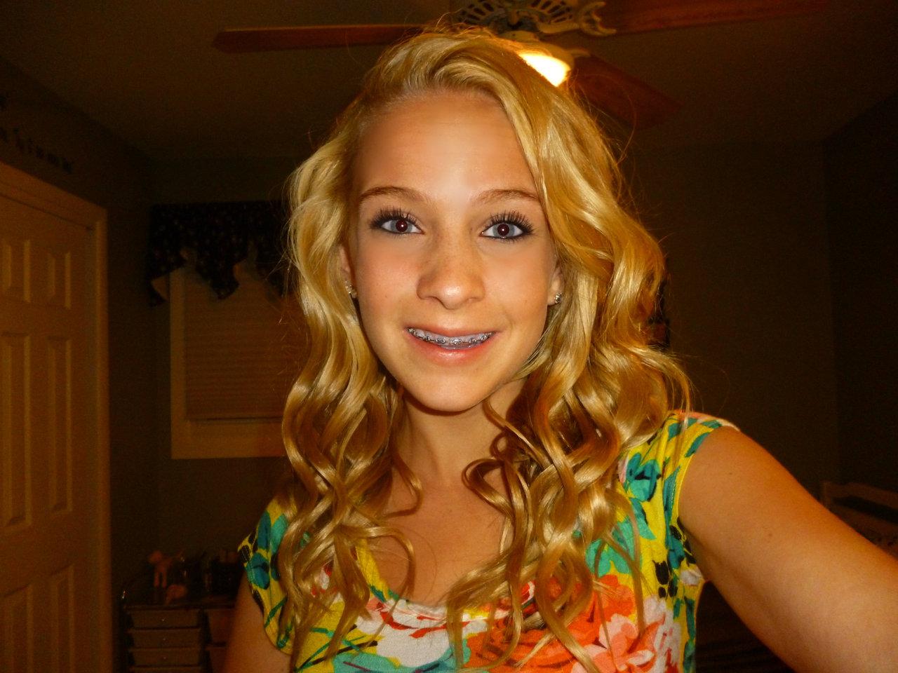 Girls With Braces On Twitter Golden Curls Braces