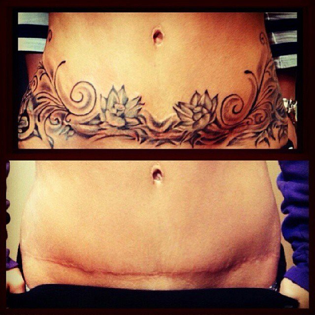 Share More Than 69 Tummy Tuck Tattoo Ideas Vn