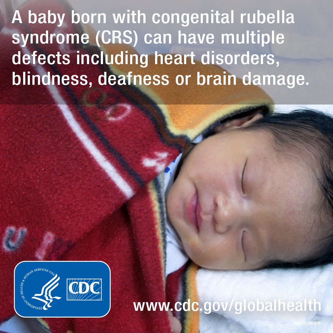 Congenital Rubella