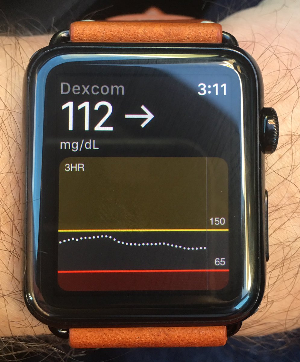 Does Dexcom Follow Work On Apple Watch does-dexcom-follow-work-on-apple-watch