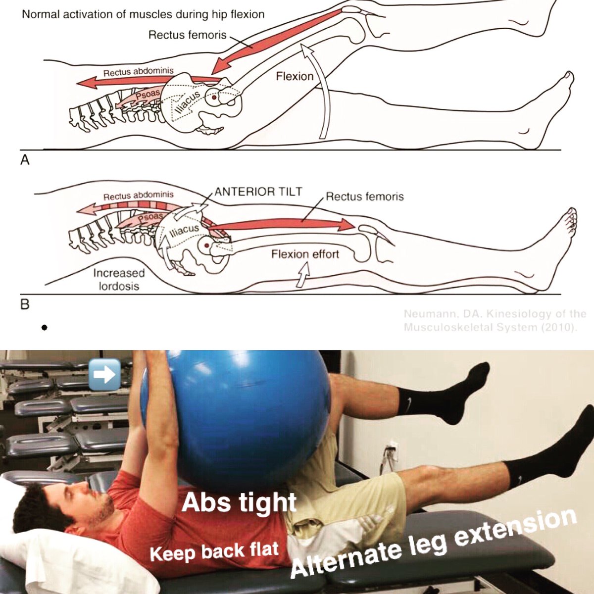 Leg Tilt Extension