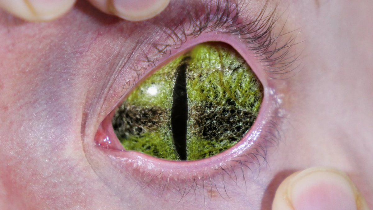 Humans With Snake Eyes