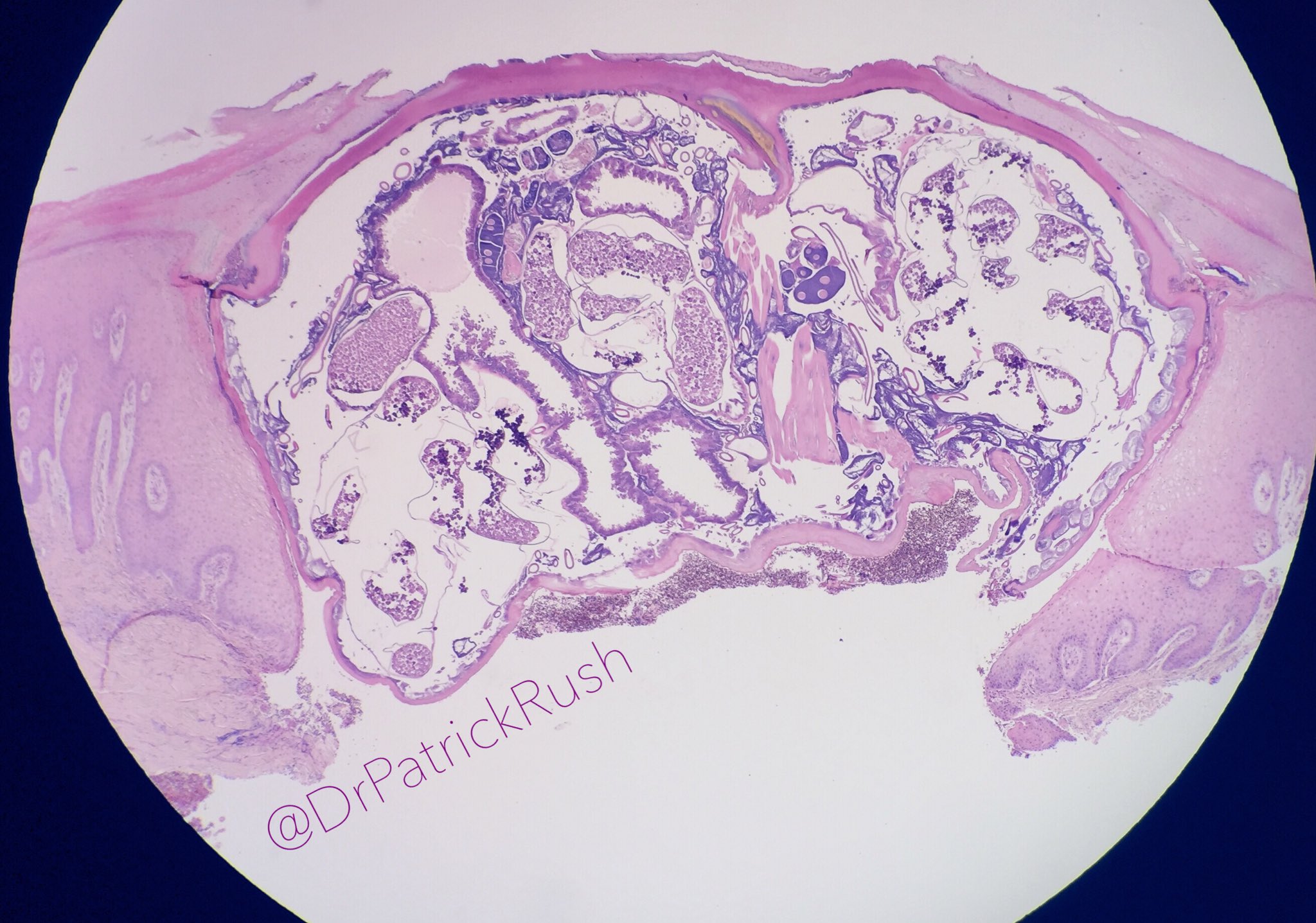 Histologia Do Tunga Penetrante Histologia Do Sistema Respiratório