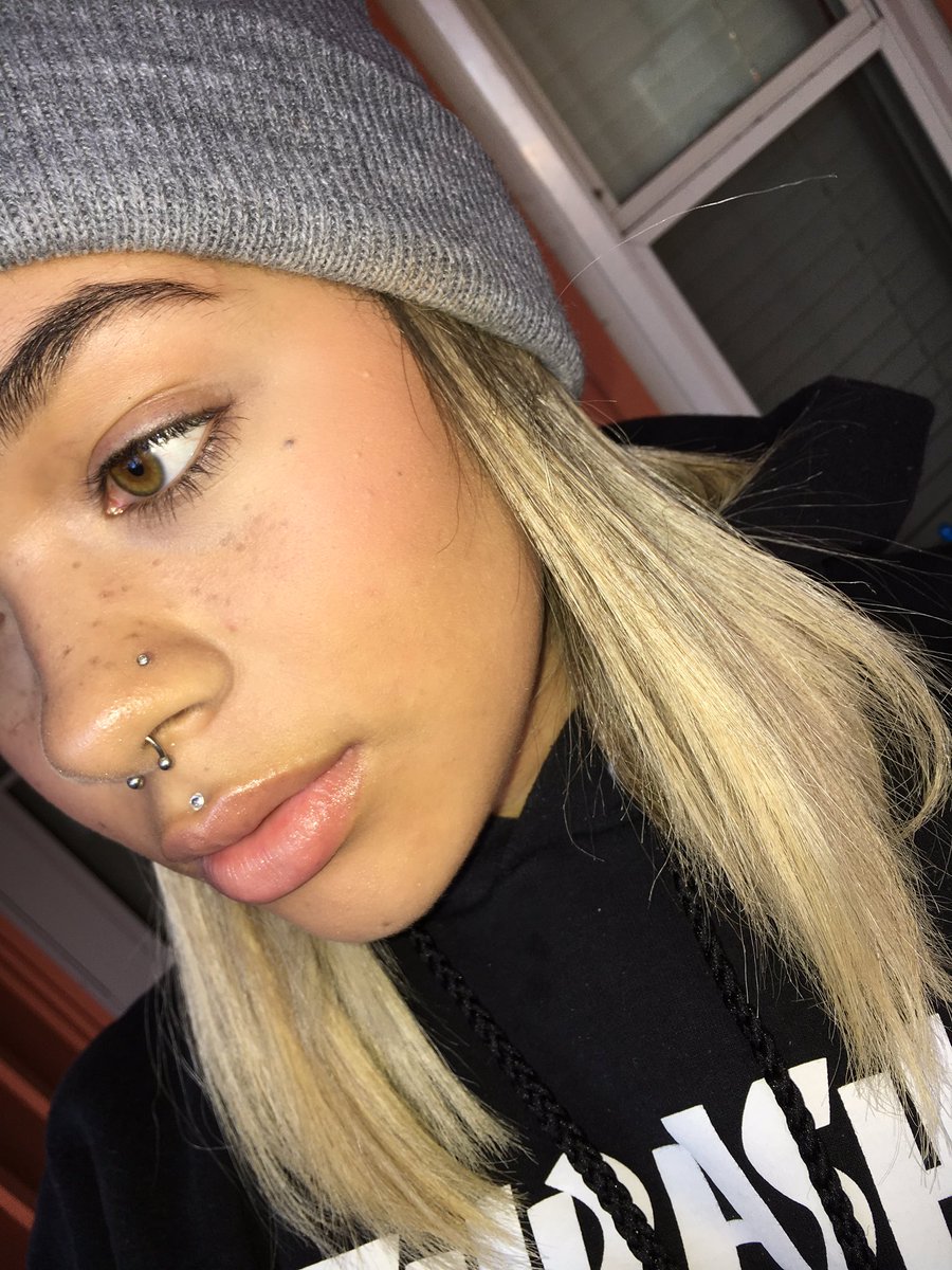 Medusa Piercing Scar