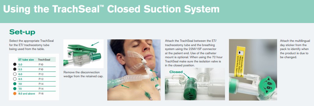 Tracheostomy Suctioning Closed System