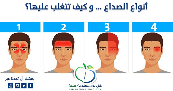 كل يوم معلومة طبية هناك 14 نوع من أنواع الصداع، اختر المنطقة التي تعاني