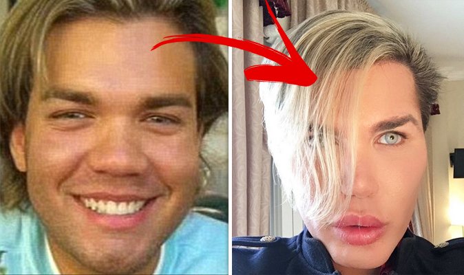 Rodrigo Alves Before And After Pics Human Ken Doll Has Had Fifty