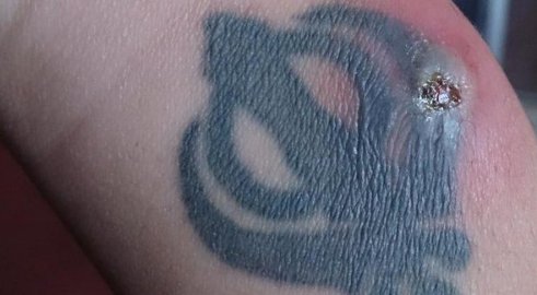 Body Modification Gone Wrong