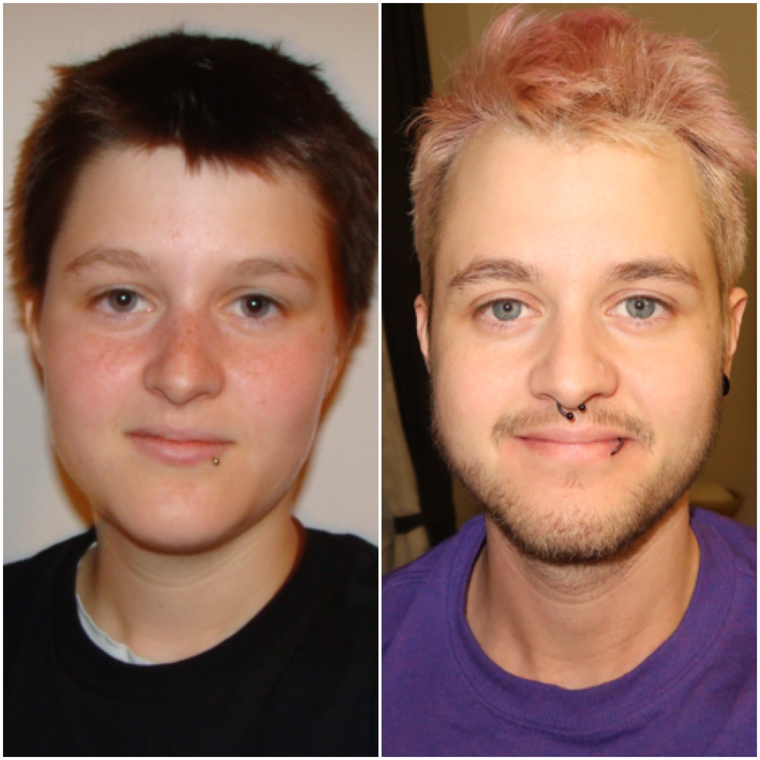 Ftm Transition Before And After Pictures