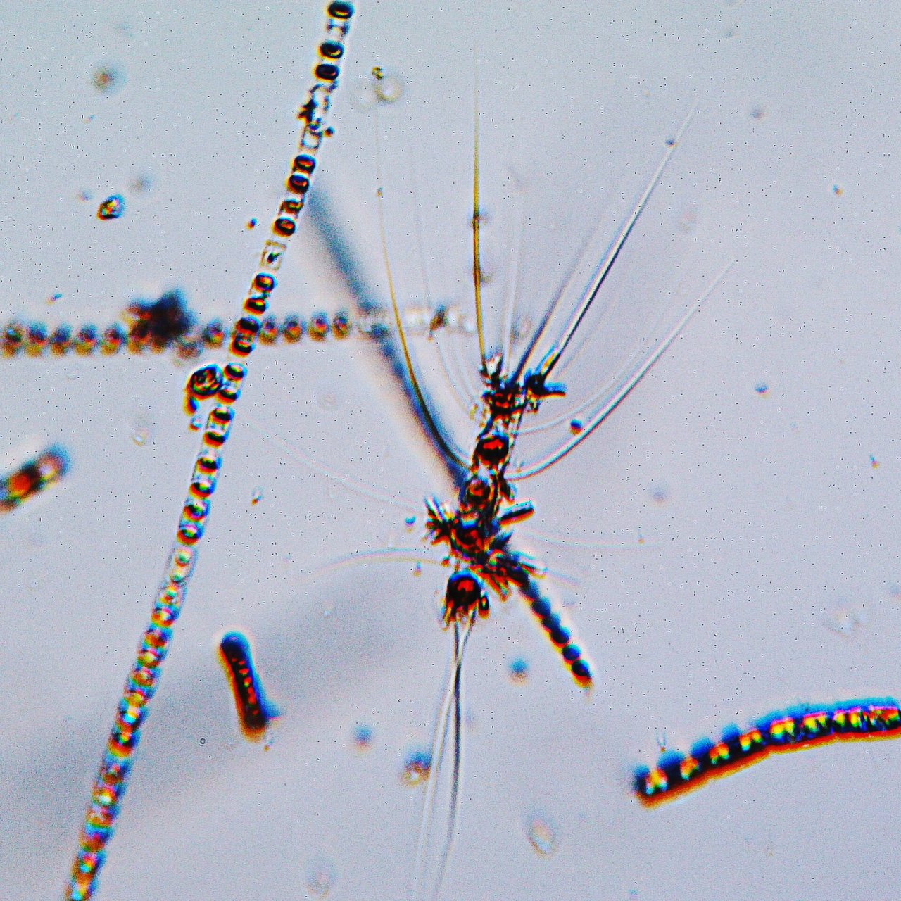Microscope World Blog: Plankton (Chaetoceros) Under The, 40% OFF