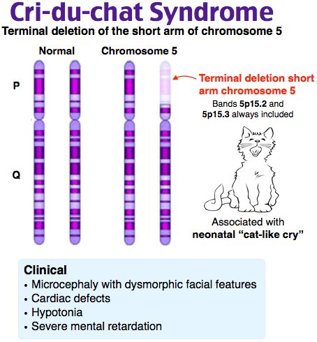 Cri Du Chat Syndrome Chromosome
