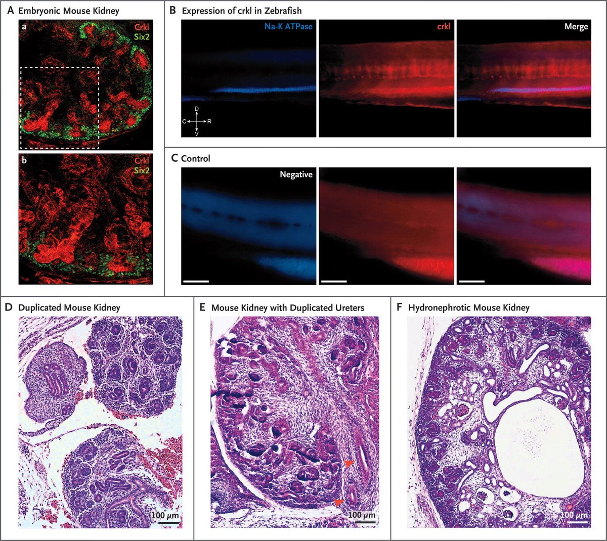 Original Article: Genetic Drivers of Kidney Defects in the DiGeorge ...
